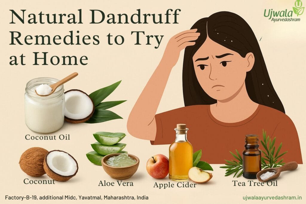 Natural Dandruff Remedies to Try at Home